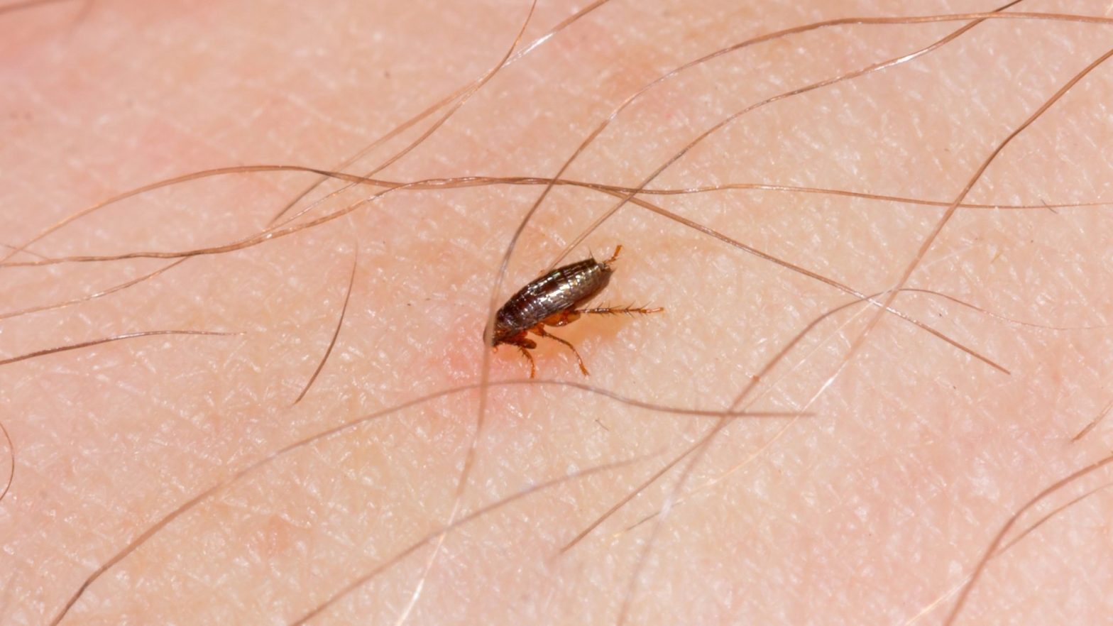 Why Do Fleas Bite Me And No One Else? - Flea Cures